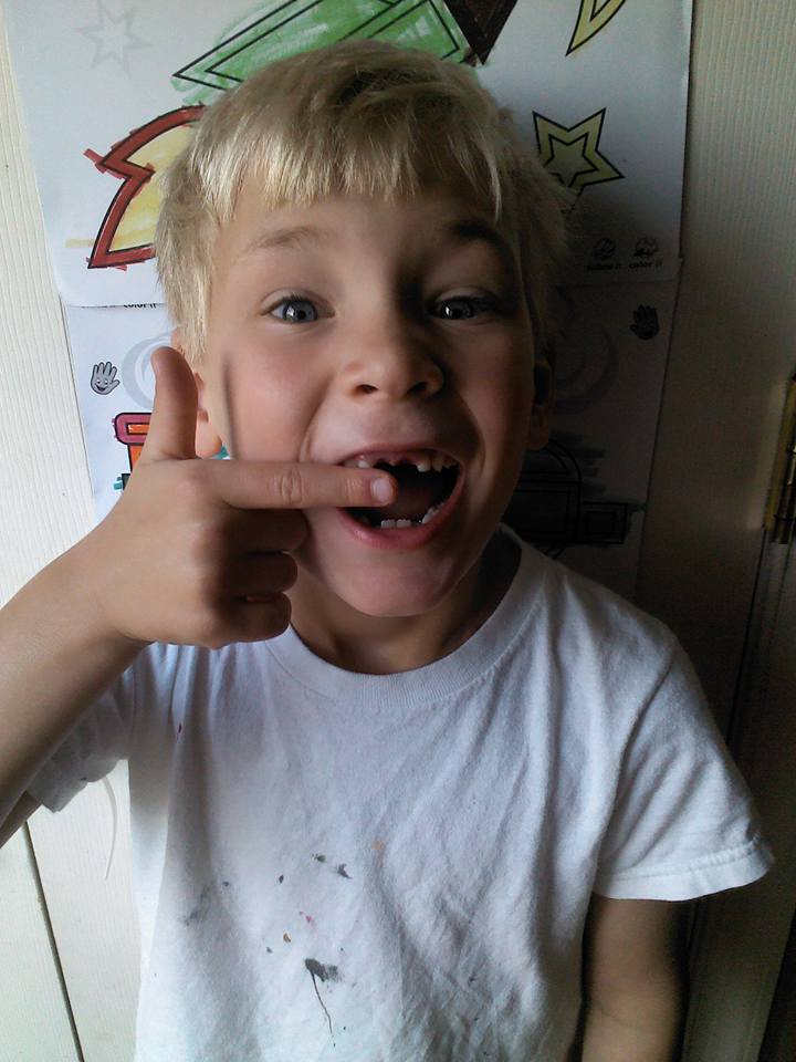 26 Kids with Big Beautiful Toothless Smiles