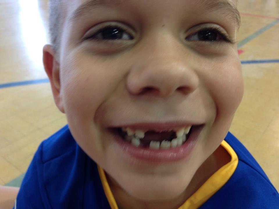 26 Kids with Big Beautiful Toothless Smiles