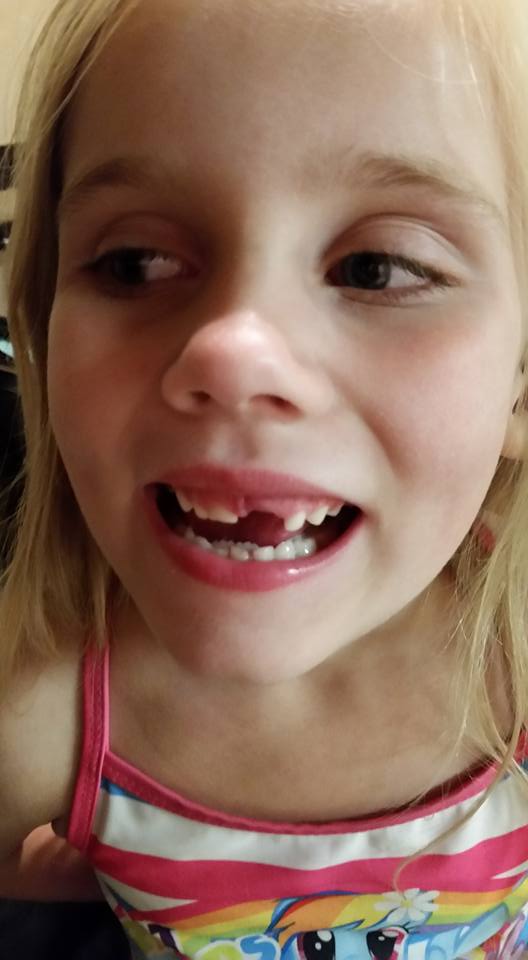 26 Kids with Big Beautiful Toothless Smiles
