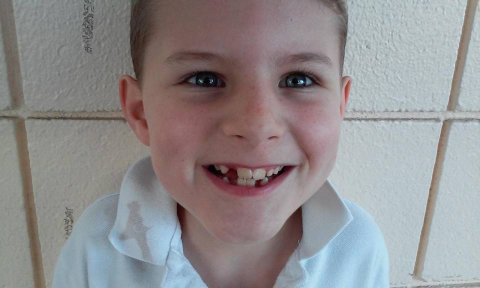 26 Kids with Big Beautiful Toothless Smiles